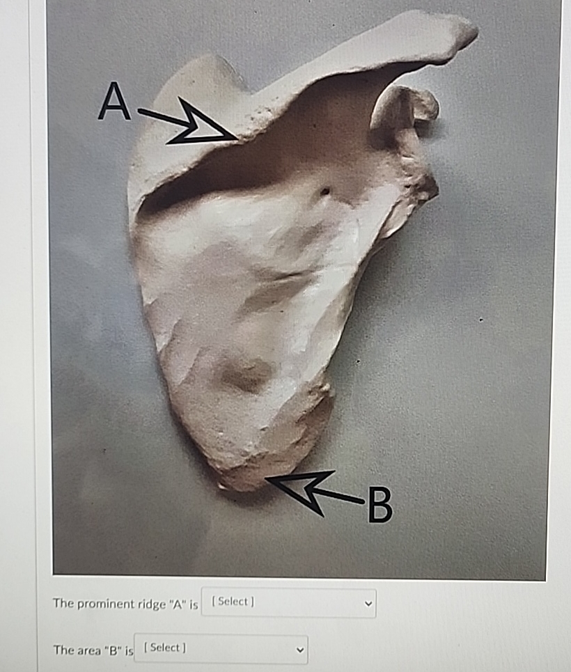 Solved The prominent ridge " A " ﻿isThe area " B " ﻿is | Chegg.com