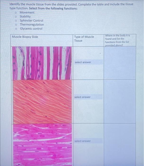 Solved Identify the muscle tissue from the slides provided. | Chegg.com
