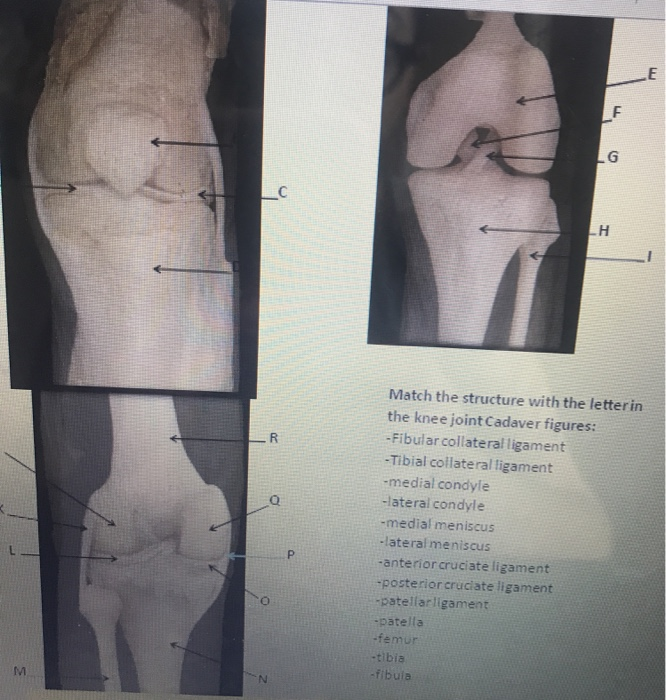 Solved 1. Identify the following labeled parts of the knee | Chegg.com