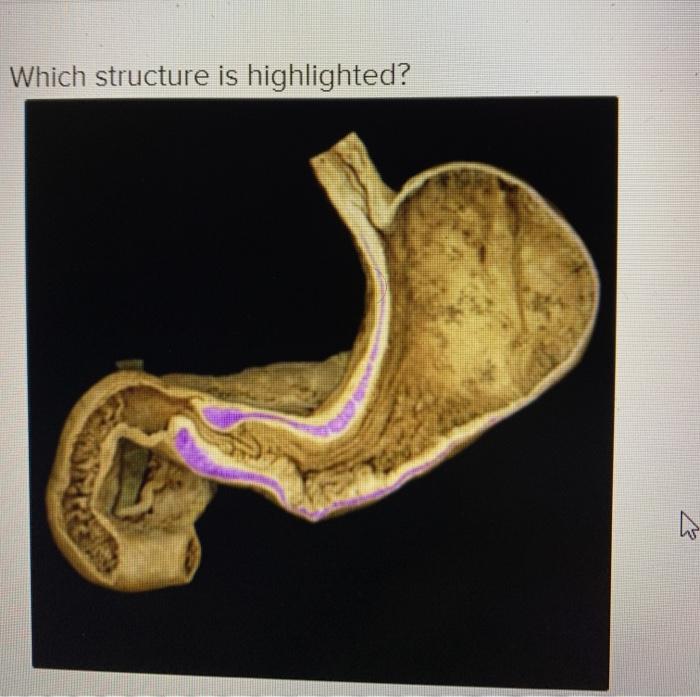 Solved Which structure is highlighted? w Multiple Choice O | Chegg.com