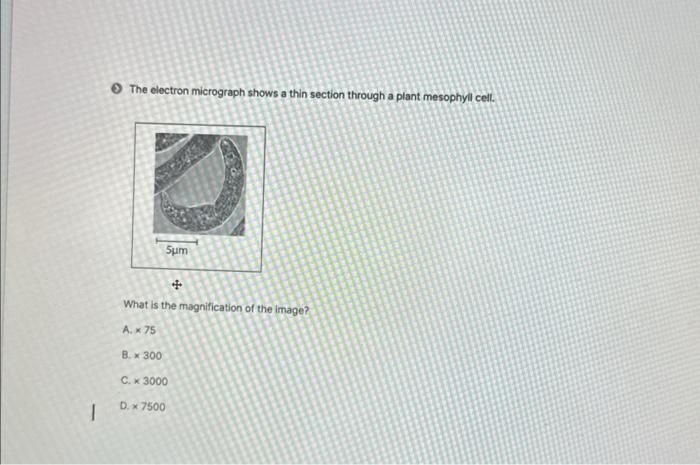 Solved The electron micrograph shows a thin section through | Chegg.com
