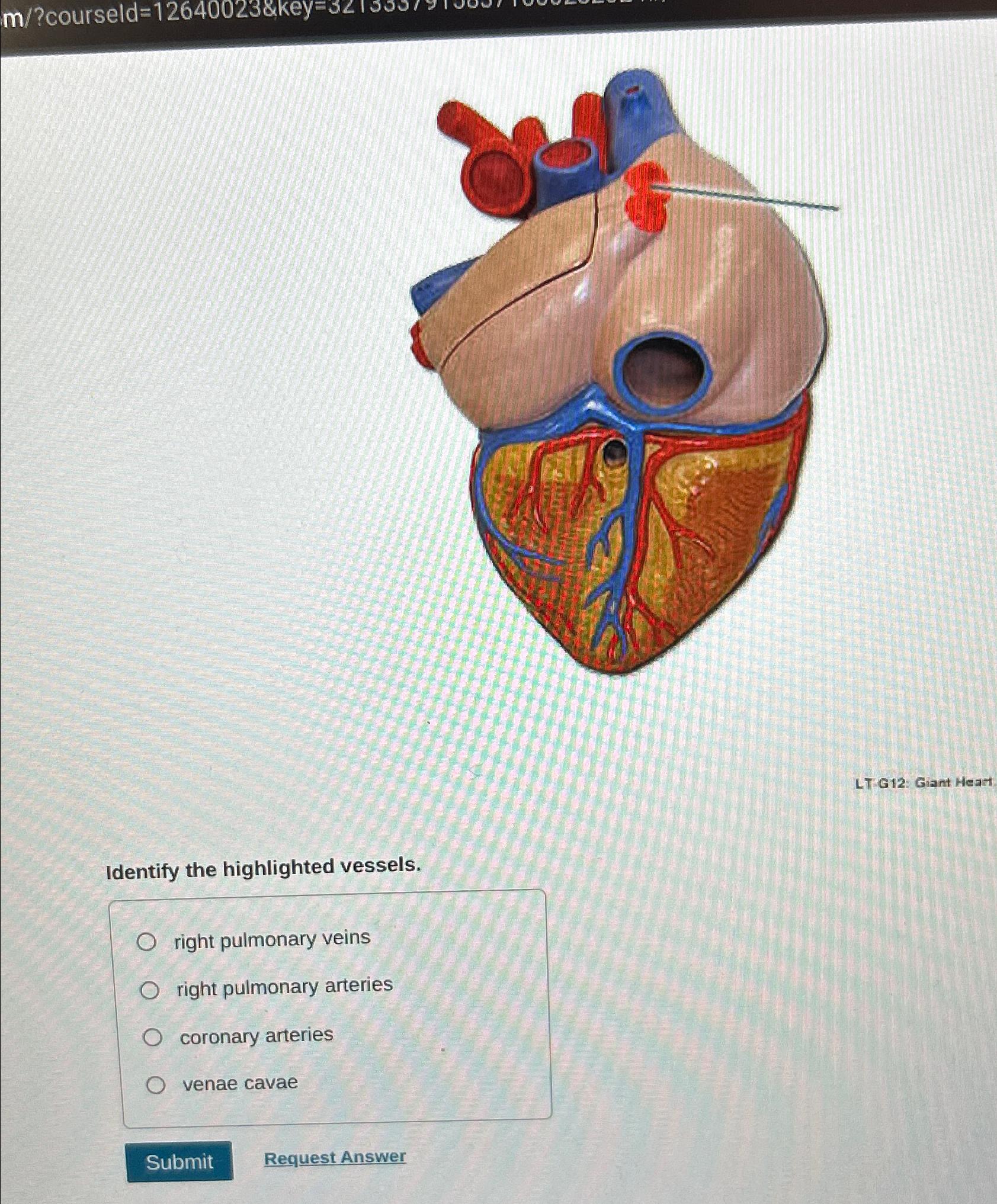 Solved LT G12: Giant HeartIdentify the highlighted | Chegg.com