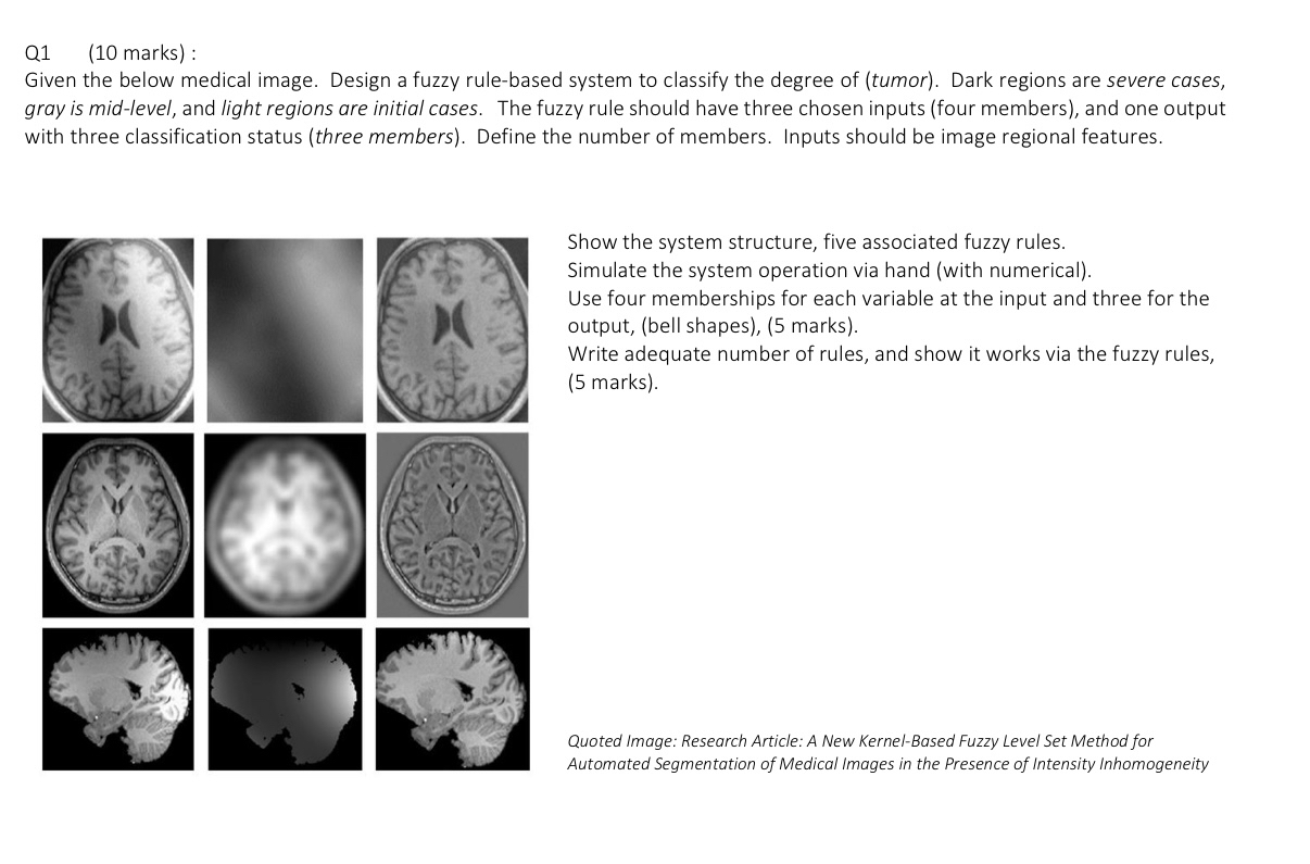 Q1 (10 ﻿marks):Given the below medical image. Design | Chegg.com