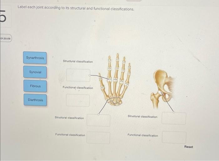 Solved Label each joint according to its structural and | Chegg.com
