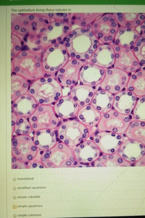 Solved The epithelium lining these tubules is: transitional | Chegg.com