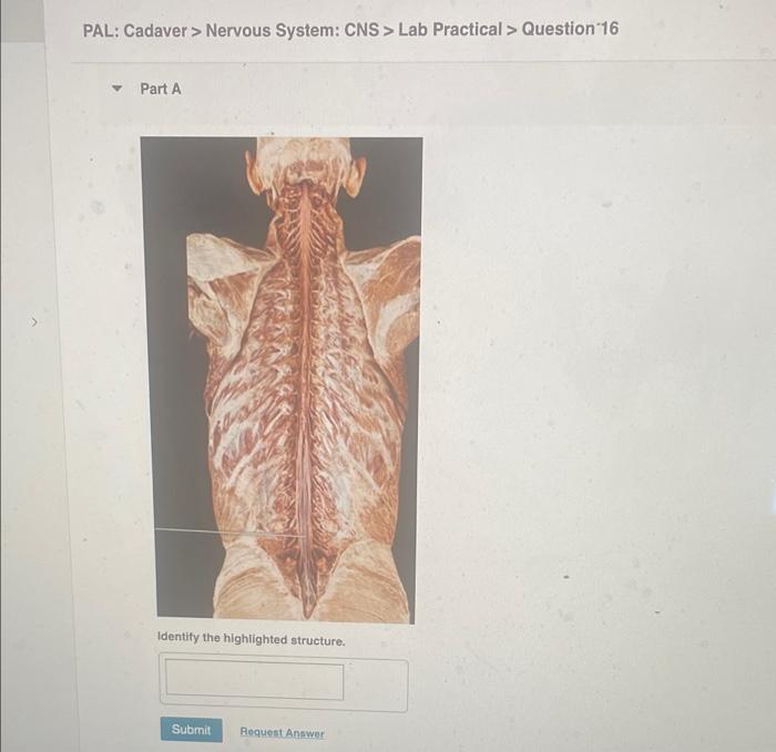 Solved PAL: Cadaver > Nervous System: CNS > Lab Practical > | Chegg.com