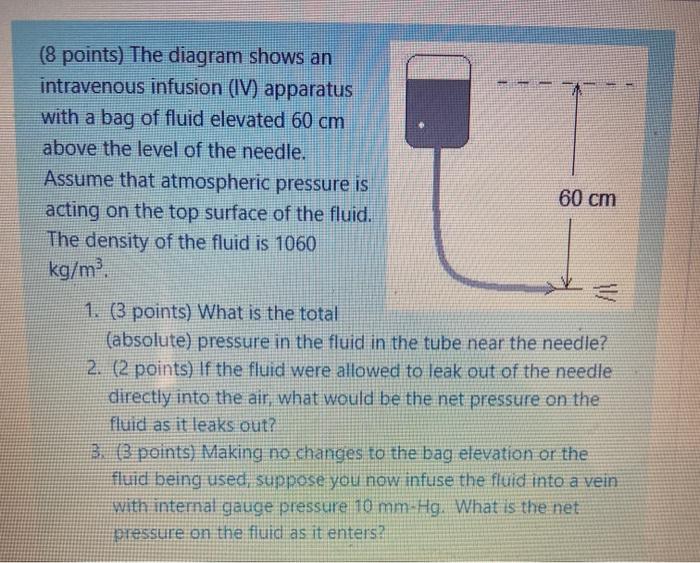 Solved (8 points) The diagram shows an intravenous infusion | Chegg.com