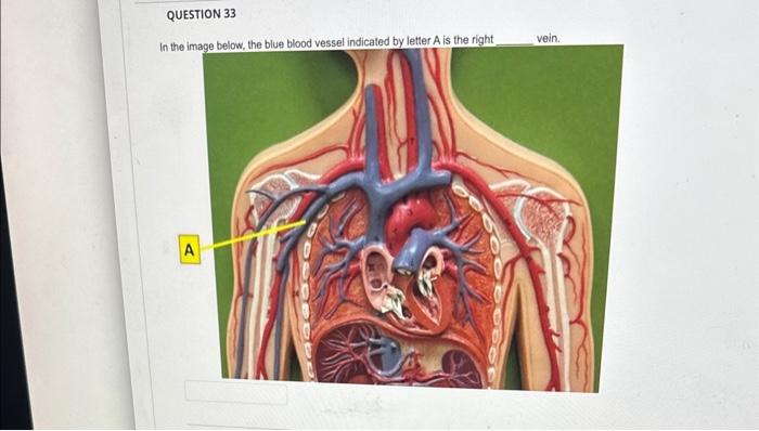 Solved veîn. | Chegg.com