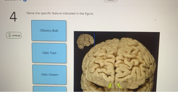 Name the specific feature indicated in the figure, 4 | Chegg.com