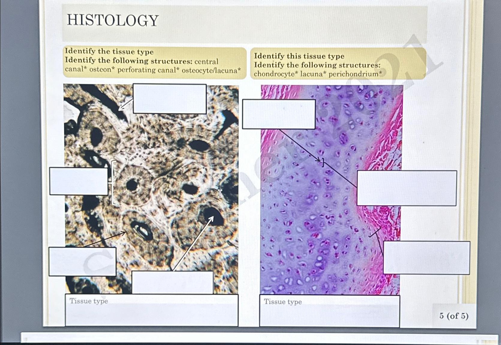 Solved HISTOLOGYIdentify the tissue type | Chegg.com
