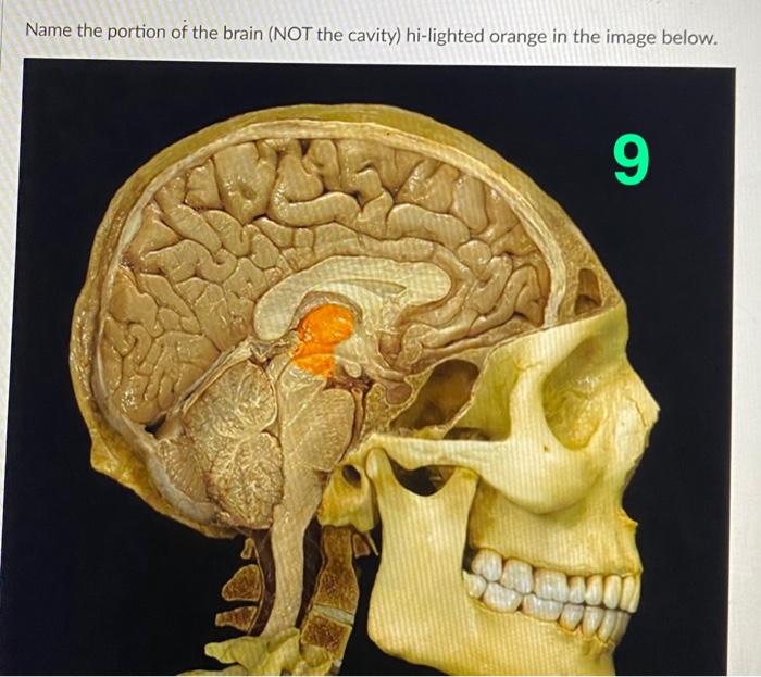 Solved Name the lobe hi-lighted orange in the image below. 1 | Chegg.com