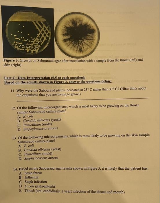 Solved Figure 3. Growth on Sabouraud agar after inoculation | Chegg.com