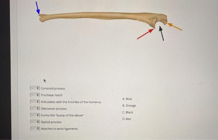 Solved Coronoid process A Blue 8. Orange • Trochlear notch • | Chegg.com