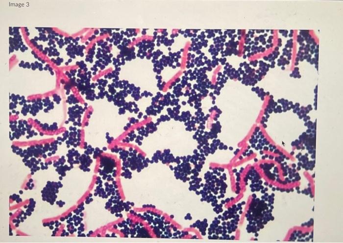 Solved Type of cell in the image based on scale bar and | Chegg.com