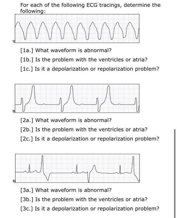Solved For each of the following ECG tracings, determine the | Chegg.com