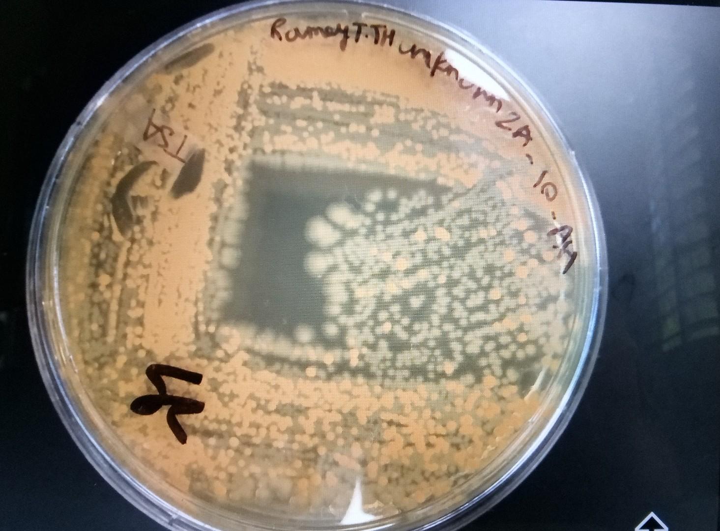 Solved - Did you get multiple single colonies on your | Chegg.com