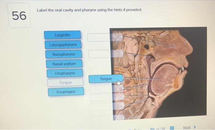 Solved Label the indicated structures or regions on this | Chegg.com