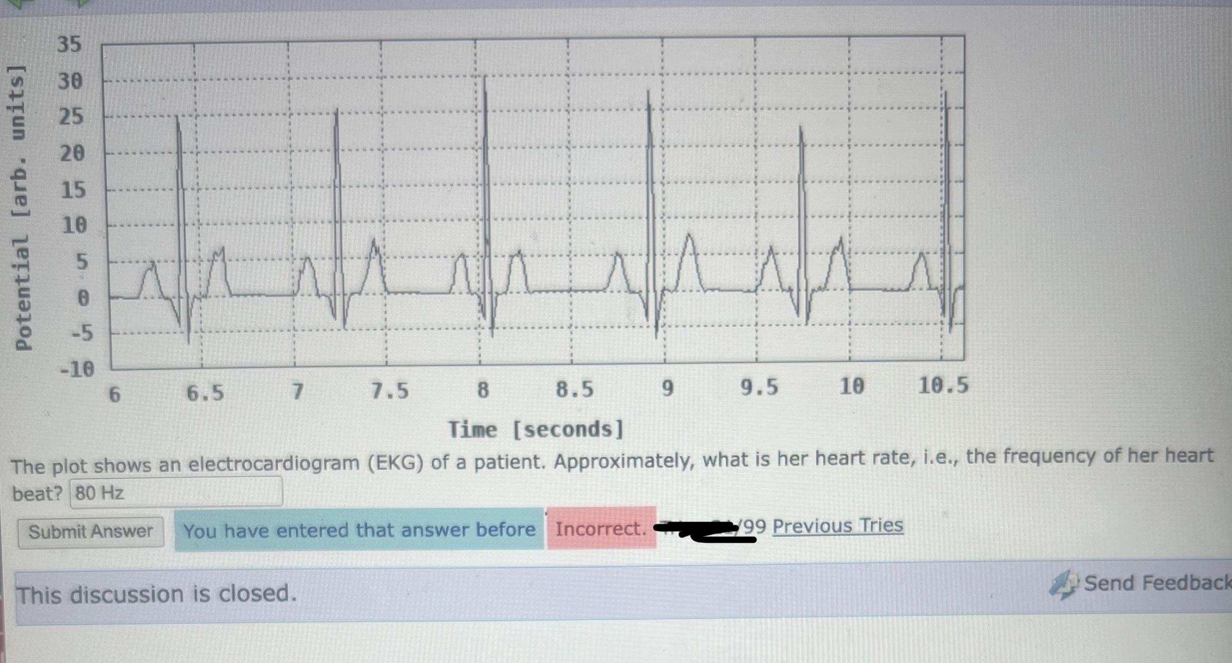 Solved The plot shows an electrocardiogram (EKG) ﻿of a | Chegg.com