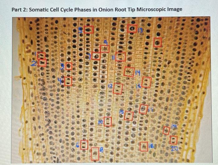 Solved Part 2: Somatic Cell Cycle Phases in Onion Root Tip | Chegg.com