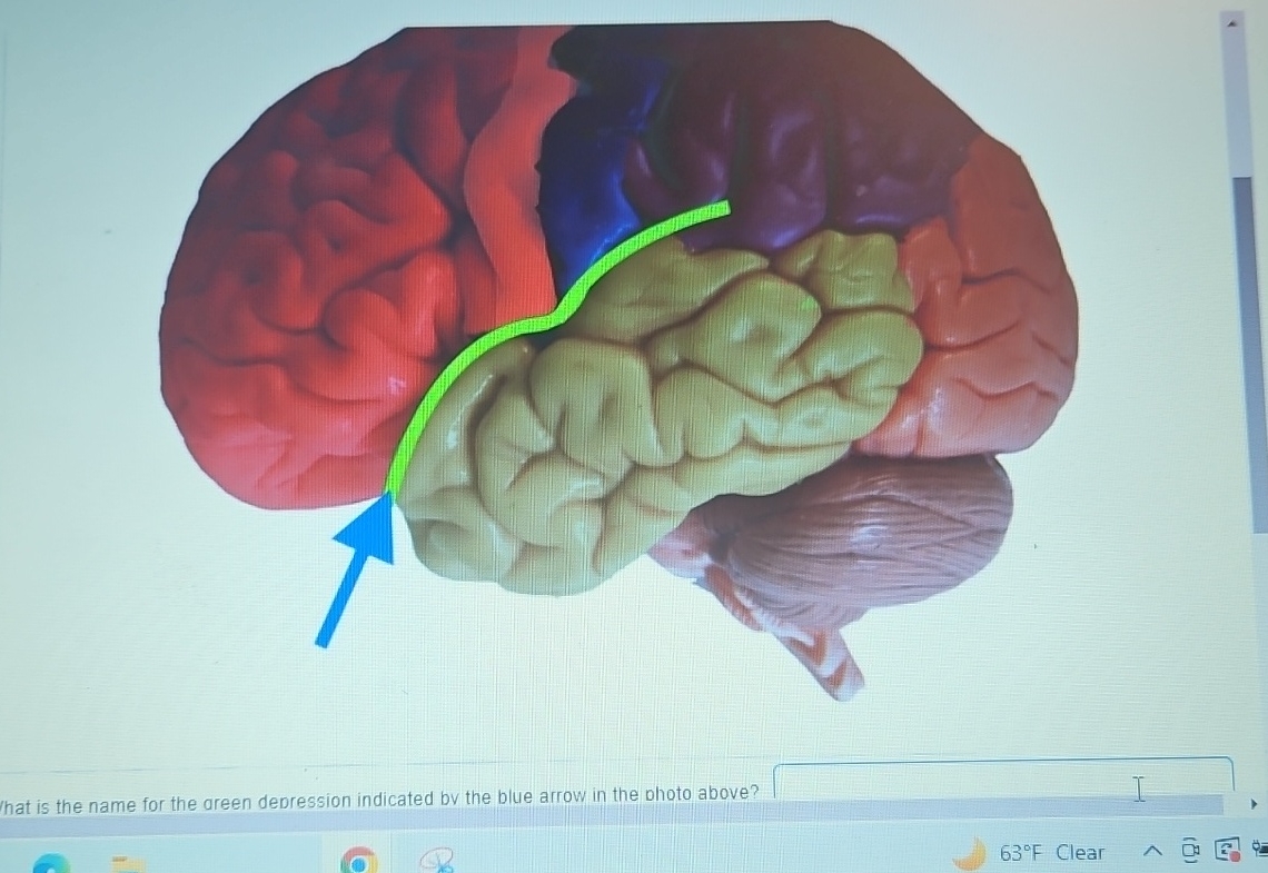Solved That is the name for the areen depression indicated | Chegg.com