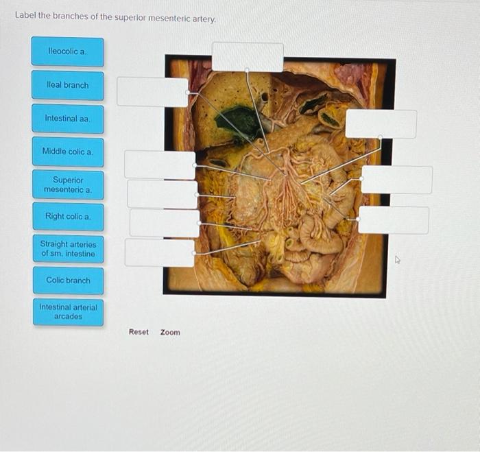 Solved Label the branches of the superior mesenteric artery, | Chegg.com