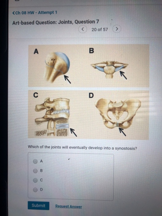 Solved А B с D Which of the joints will eventually develop | Chegg.com