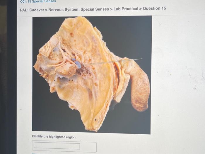 Solved Pal Cadaver Nervous System Special Senses Lab