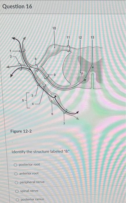 Solved Identify the structure labeled " 2 ." anterior ramus | Chegg.com