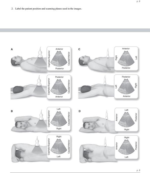 Solved 2.8 2. Label the patient position and scanning planes | Chegg.com