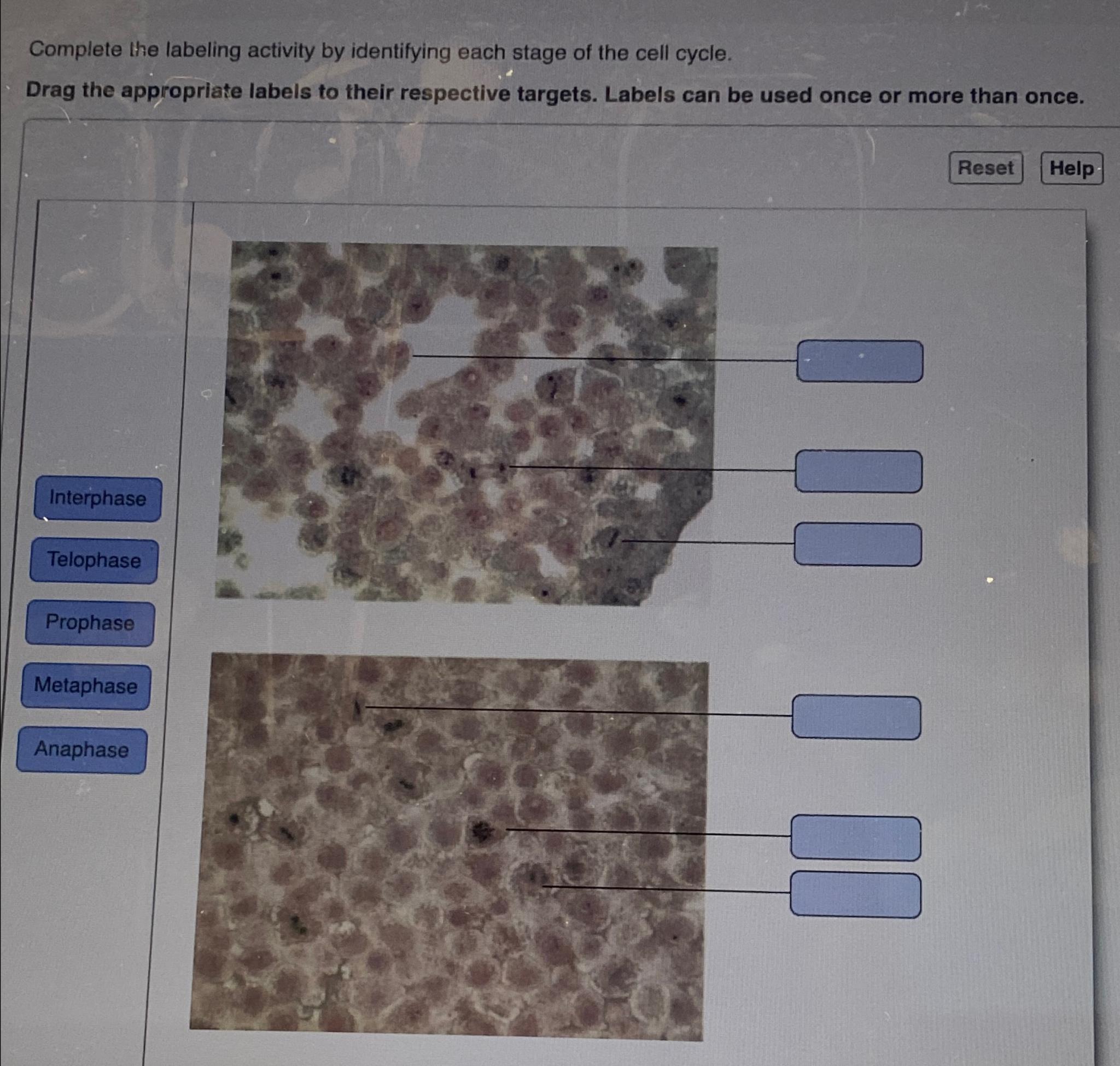 Solved Complete the labeling activity by identifying each | Chegg.com