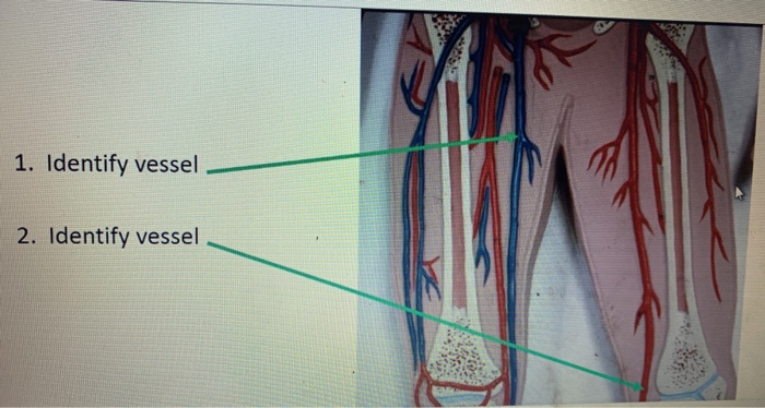 Solved 1. Identify vessel 2. Identify vessel | Chegg.com