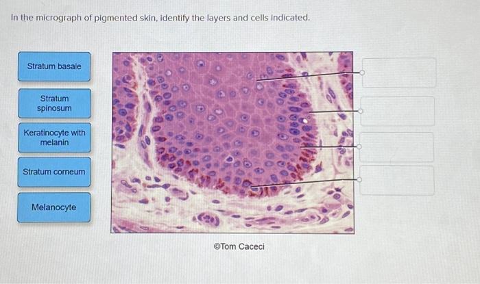 Solved In the micrograph of pigmented skin, identify the | Chegg.com