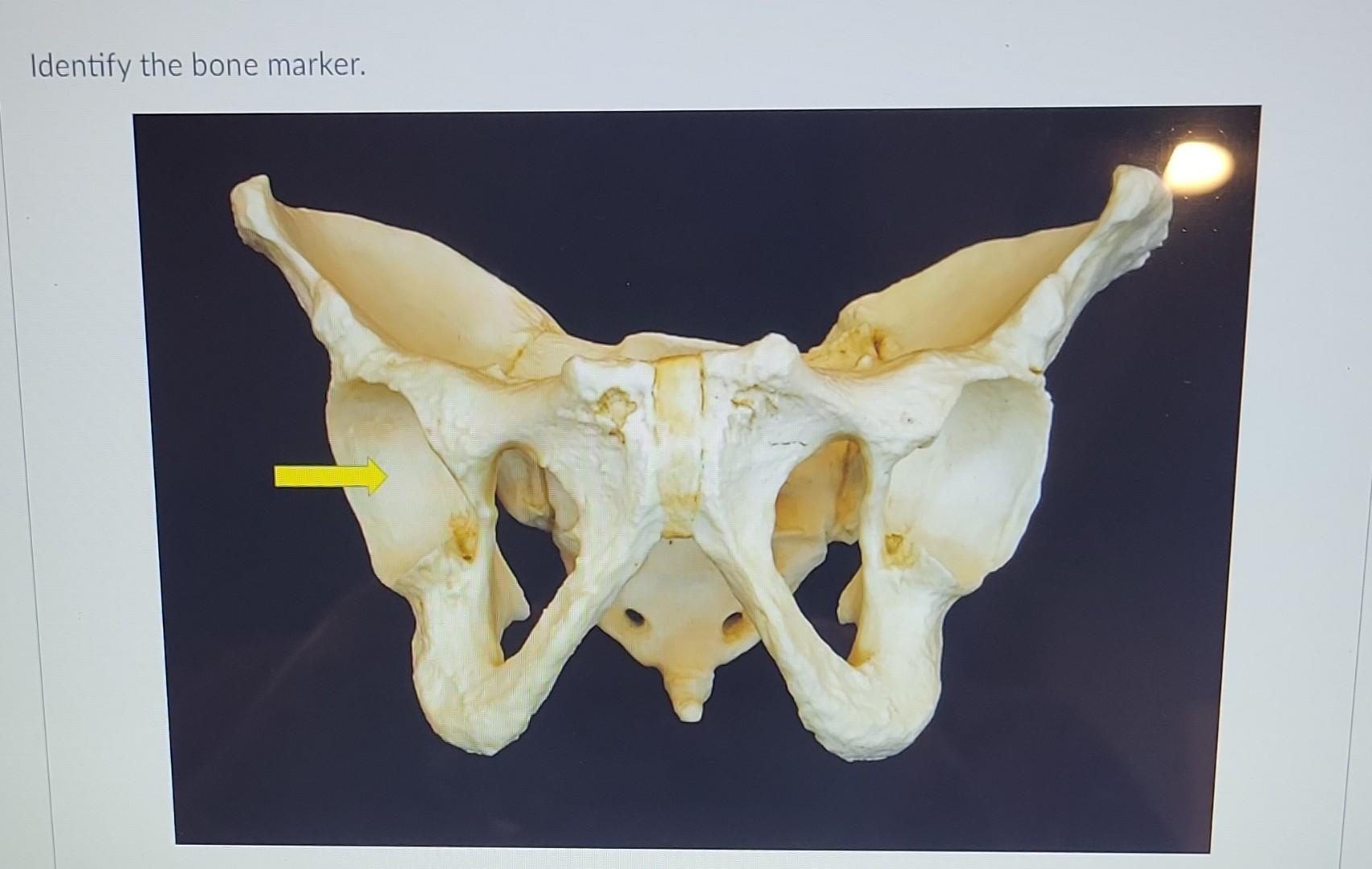 Solved Identify the bone marker indicated by the red | Chegg.com