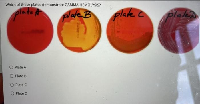 Solved Which of these plates demonstrate GAMMA-HEMOLYSIS? | Chegg.com