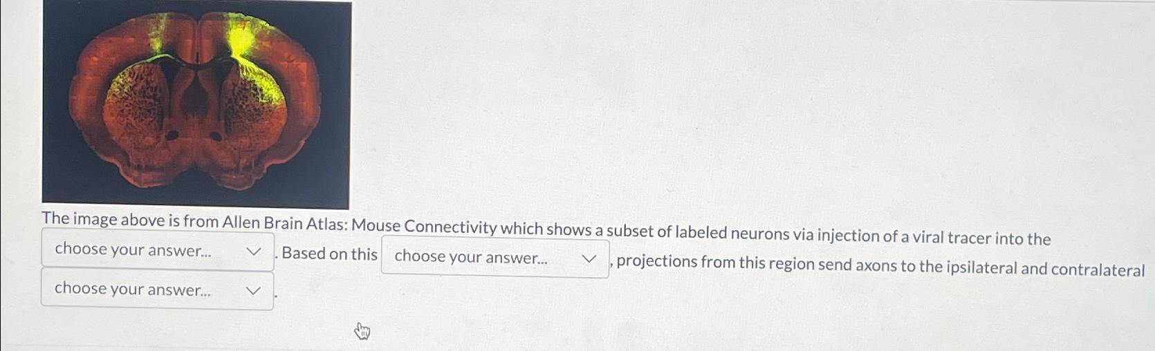The image above is from Allen Brain Atlas: Mouse | Chegg.com