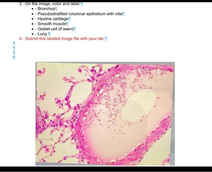 3. → On the image, color and label: - Bronchus\| - | Chegg.com