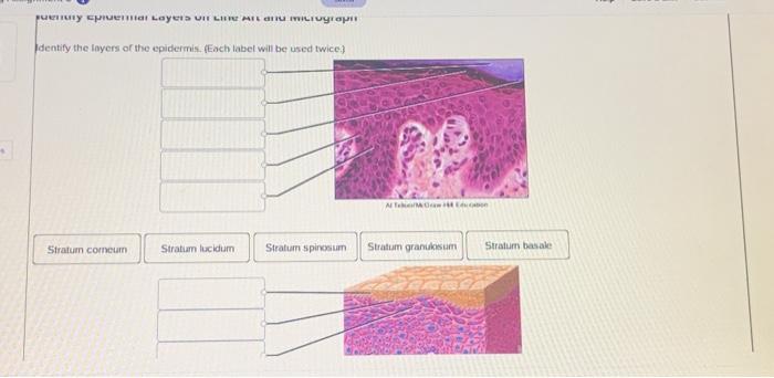 Solved Dentify The Layers Of The Epidermis Each Label Will