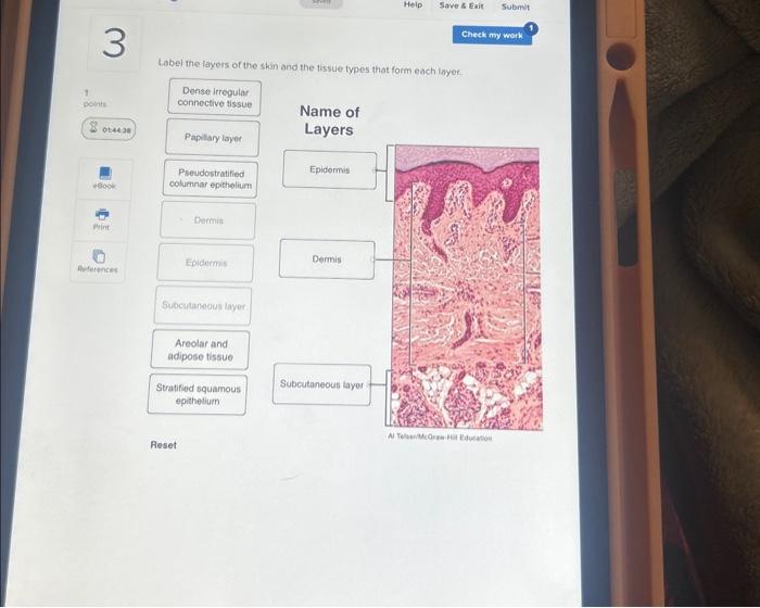 Solved Label the layers of the skin and the tissue types | Chegg.com