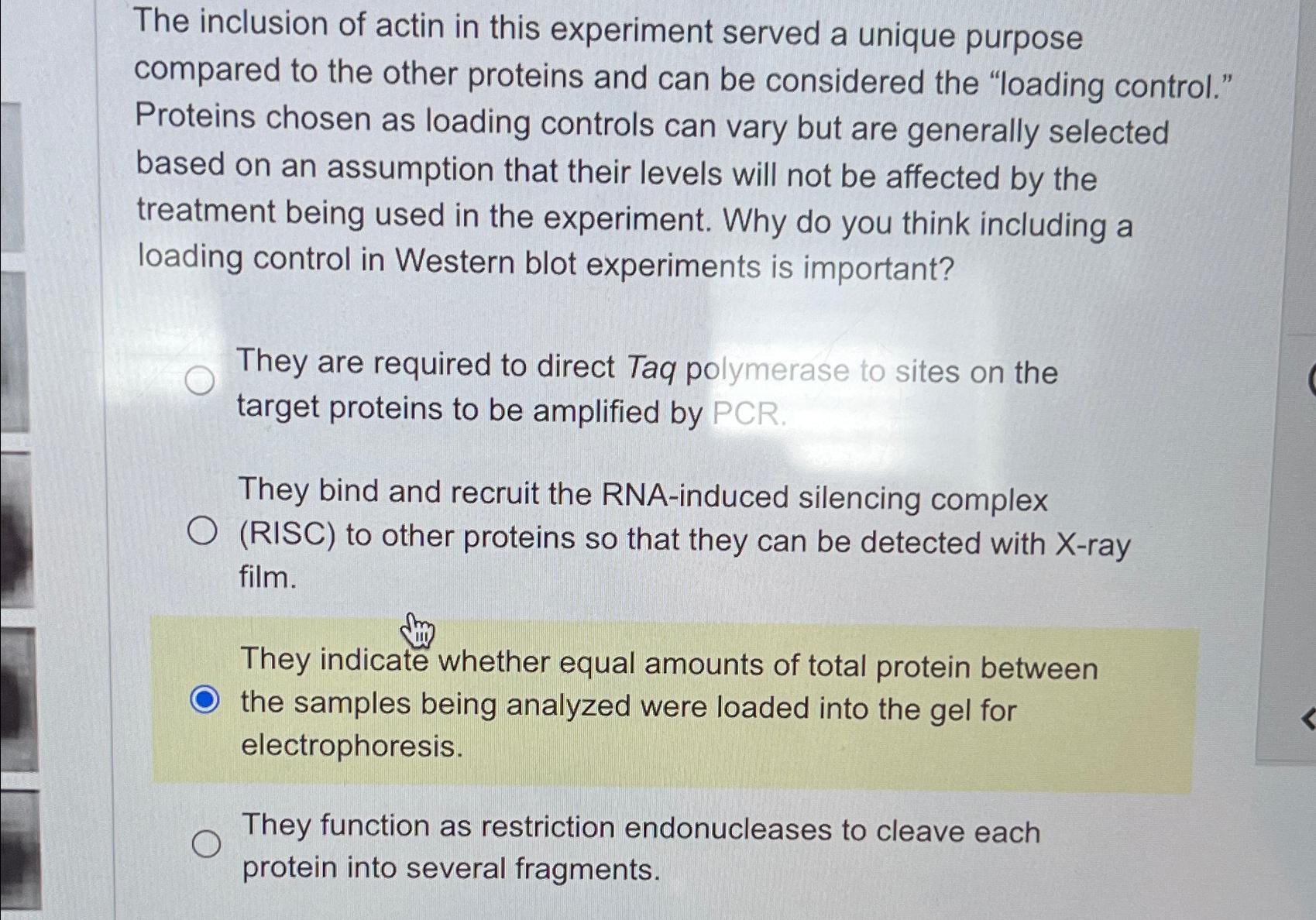 Solved The inclusion of actin in this experiment served a | Chegg.com