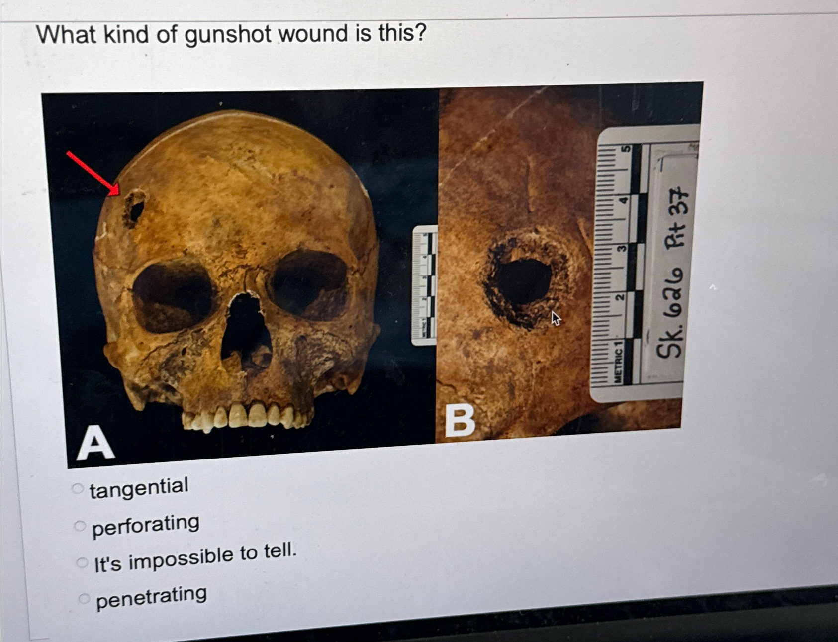 What kind of gunshot wound is this? ﻿tangential | Chegg.com