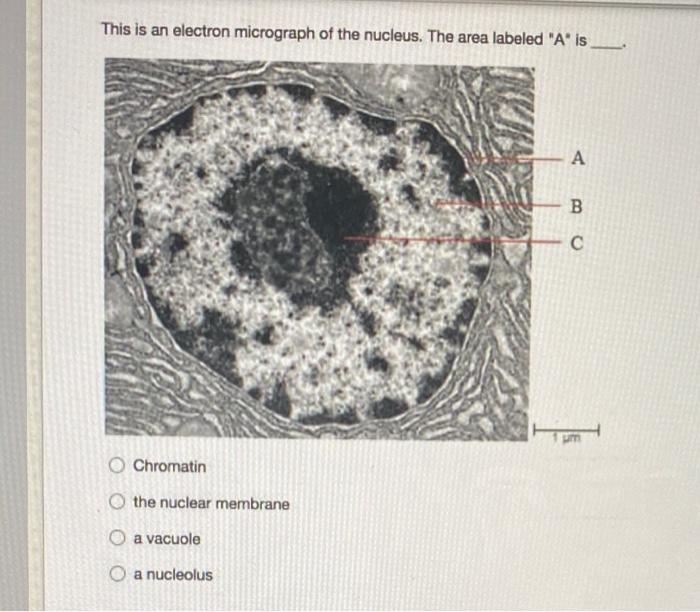 Nucleus Electron Micrograph