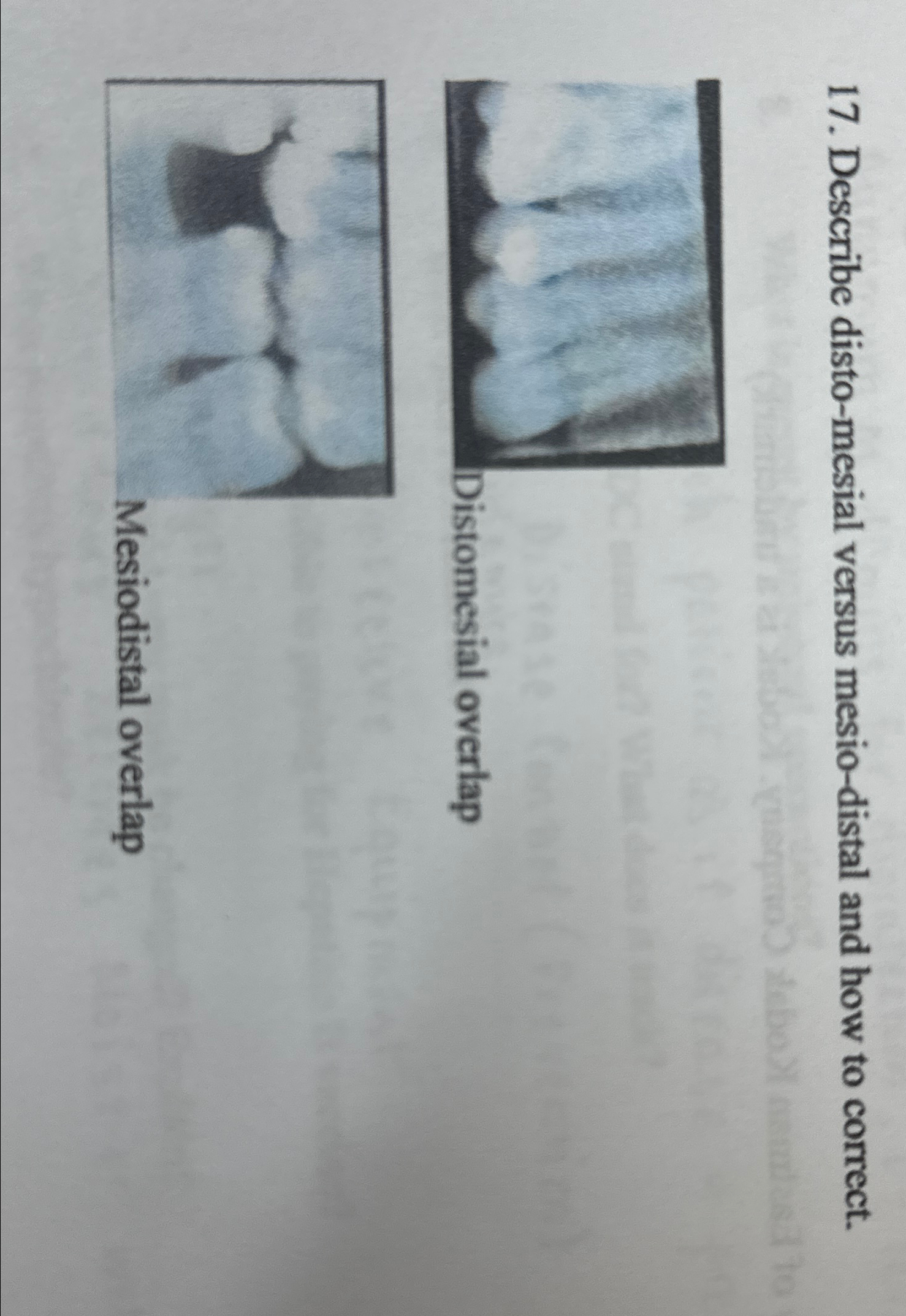 Describe disto-mesial versus mesio-distal and how to | Chegg.com