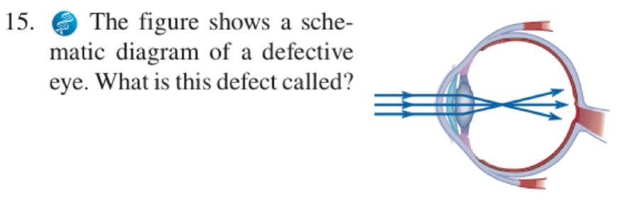 Solved The figure shows a schematic diagram of a defective | Chegg.com