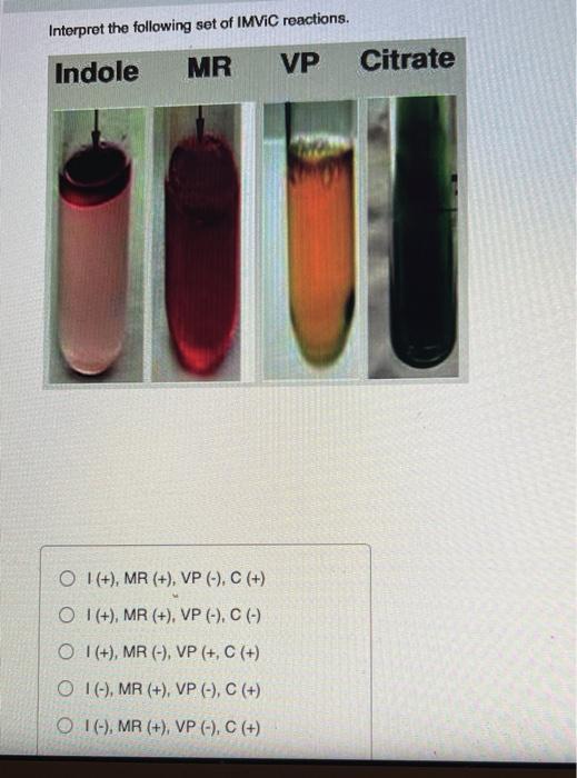 Solved Interpret the following set of IMVic reactions. | Chegg.com