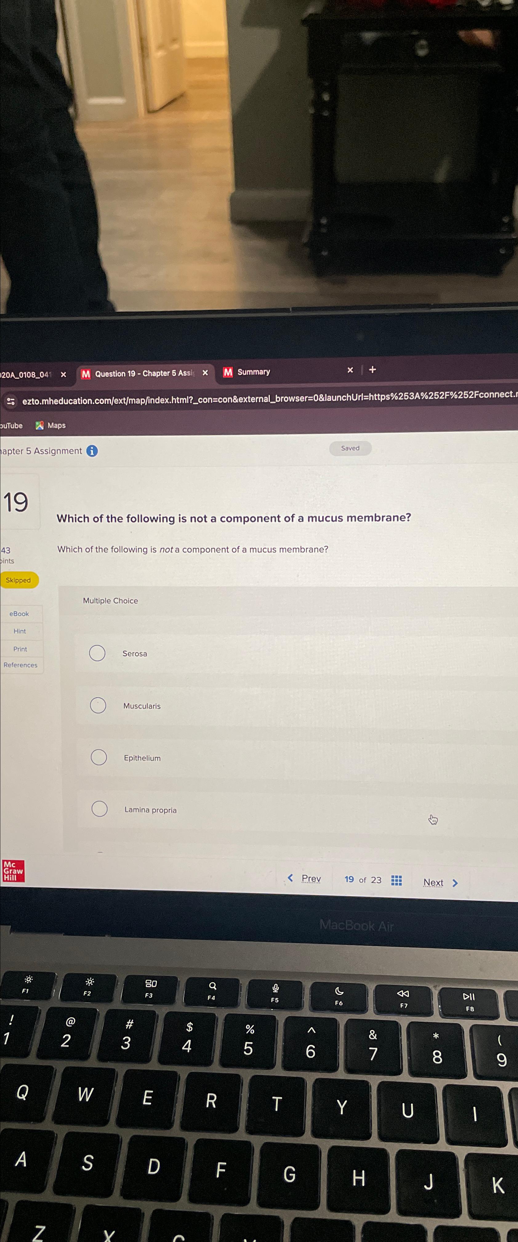 Solved Which of the following is not a component of a mucus | Chegg.com