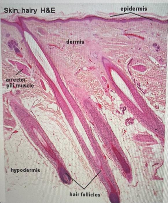 Solved 1. Observe the palmar skin (thick skin) pictures | Chegg.com