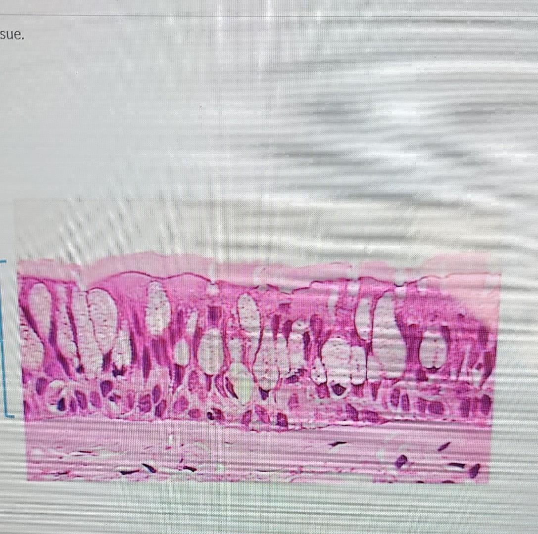 Solved sue. PRO fe regular tissue | Chegg.com