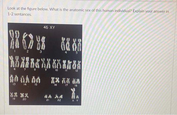 Solved Look At The Figure Below What Is The Anatomic Sex Of