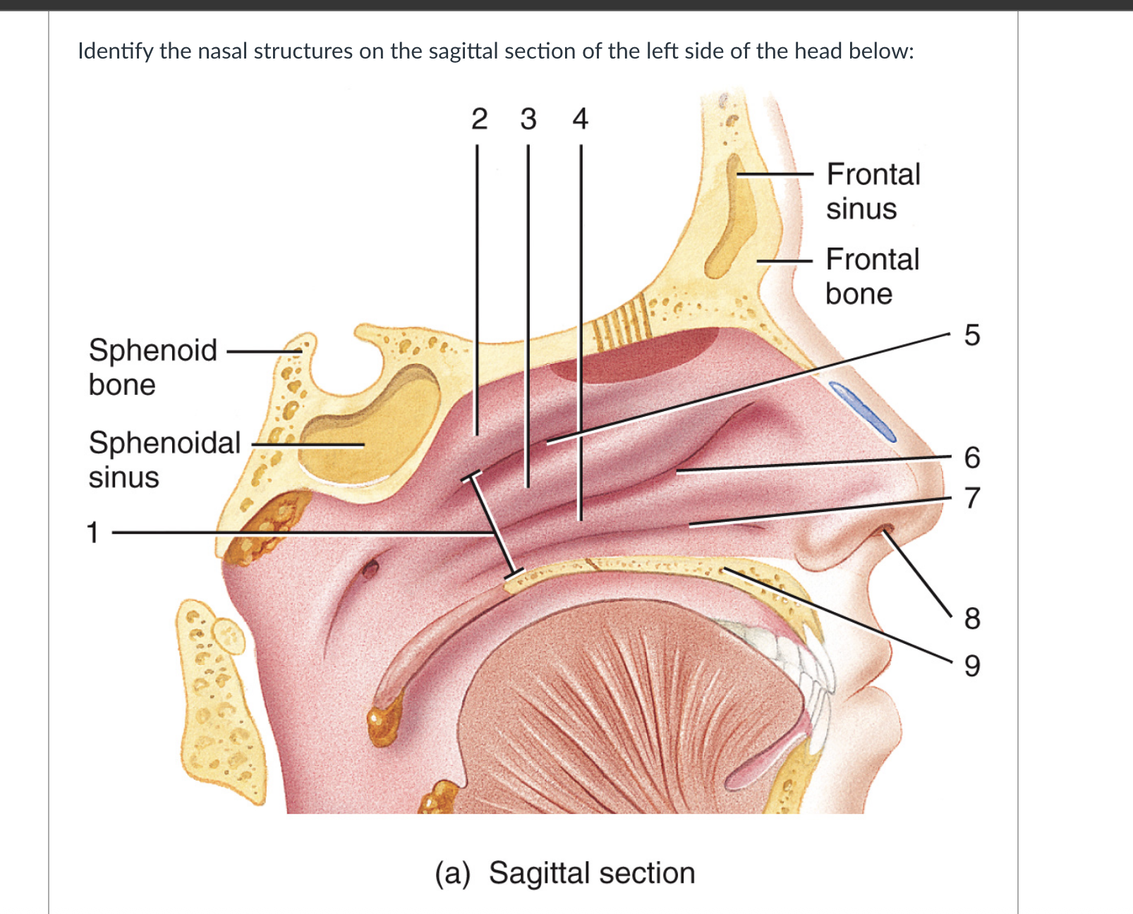 Solved Identify the nasal structures on the sagittal section | Chegg.com