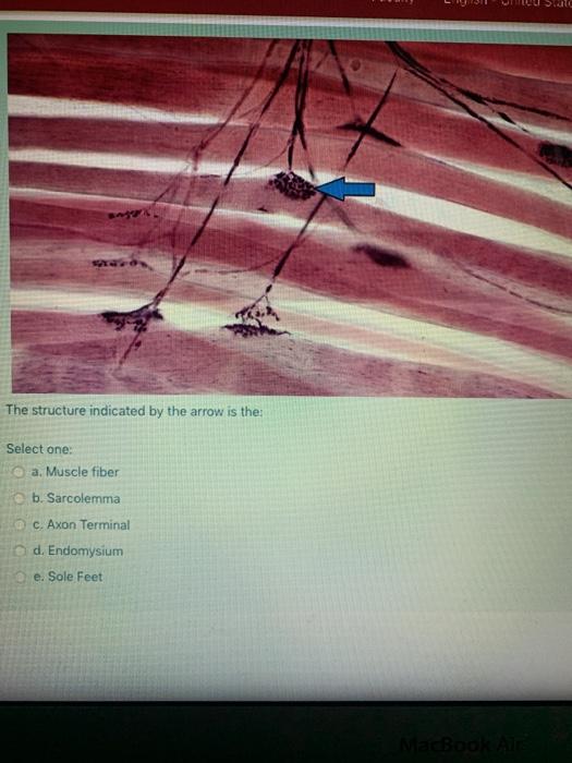 Solved 1。 What is the vessel indicated by the yellow | Chegg.com